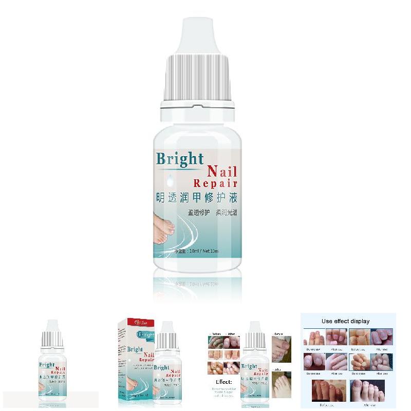 10ml Nail Fungal Treatment , ,Anti Fungus Onychomycosis Removal Toenail ...