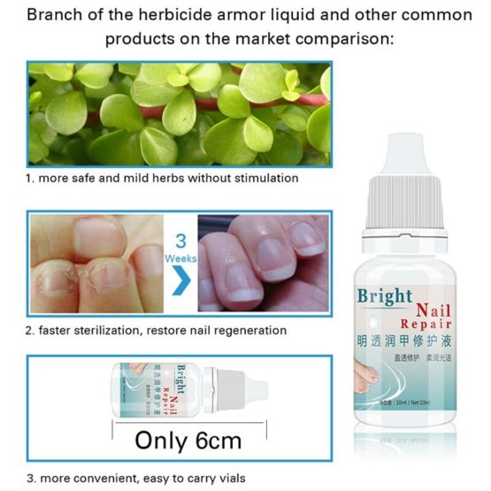 10ml Nail Fungal Treatment , ,Anti Fungus Onychomycosis Removal Toenail ...
